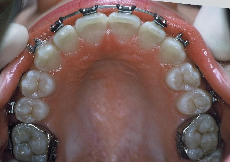 Gerety Orthodontic Seminars